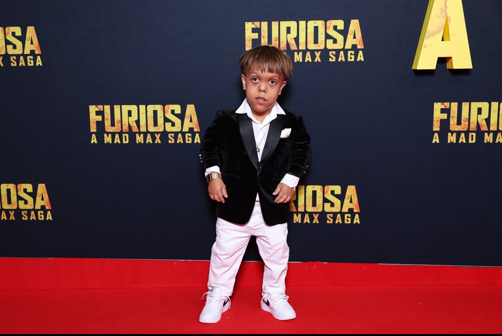 Quaden Bayles - Bullied Boy With Dwarfism - Delights Viewers With Role ... Quaden Bayles - Bullied Boy With Dwarfism - Delights Viewers With Role ...