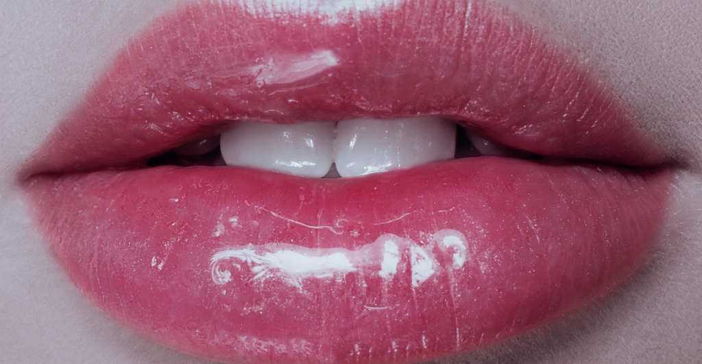 Woman with the 'world's biggest lips' shares photo of herself before ...